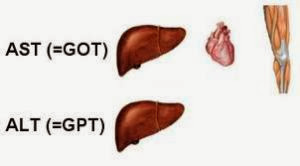 SGOT (Serum Glutamic Oxaloacetic Transaminase) ~ Info Laboratorium ...