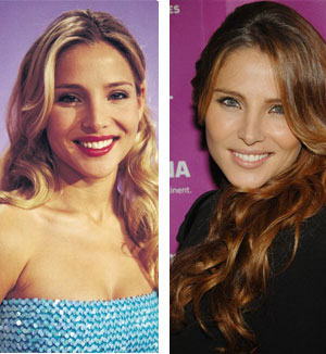 Fotos de famosos antes y después de pasar por quirófano. ¿Cómo pueden ...