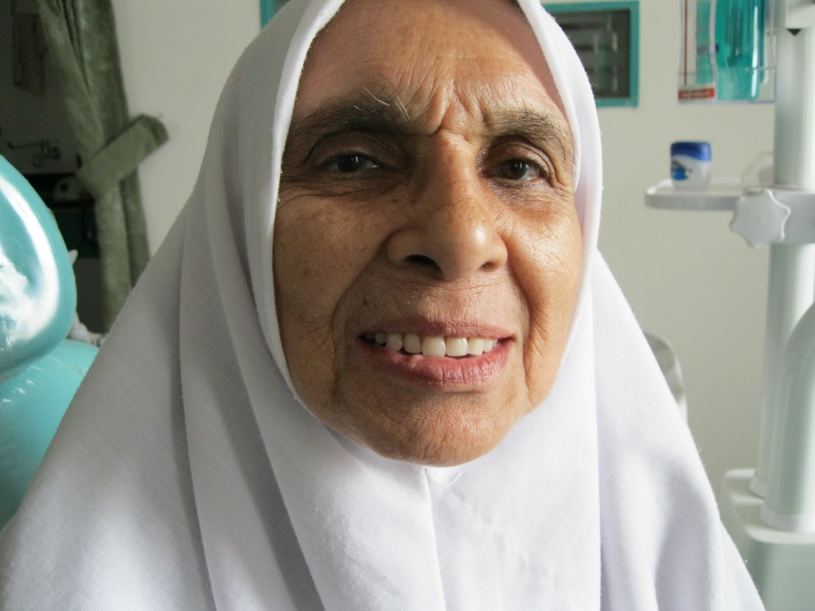 DENTO CARE DENTAL CLINICS: SUNFLEX COMPLETE DENTURE