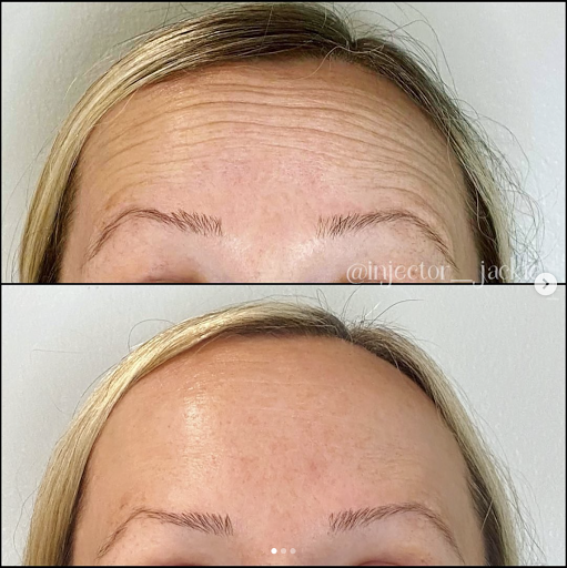 Excelsia Injury Care Warminster - Specialist in Beauty Services at 600 ...
