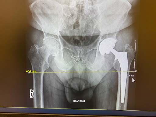 Orthopedic Surgeon | George Gendy MD