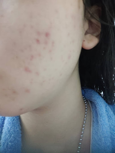 Klinik Kulit Socka - Taman Emas, Perai, Penang - Zaubee