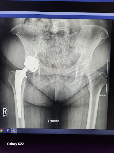 Orthopedic Surgeon | George Gendy MD