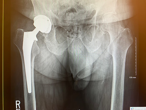 Orthopedic Surgeon | George Gendy MD