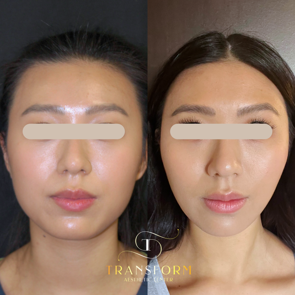 Transform Aesthetic Center - New Smyrna Beach, FL 32168 - Services and ...